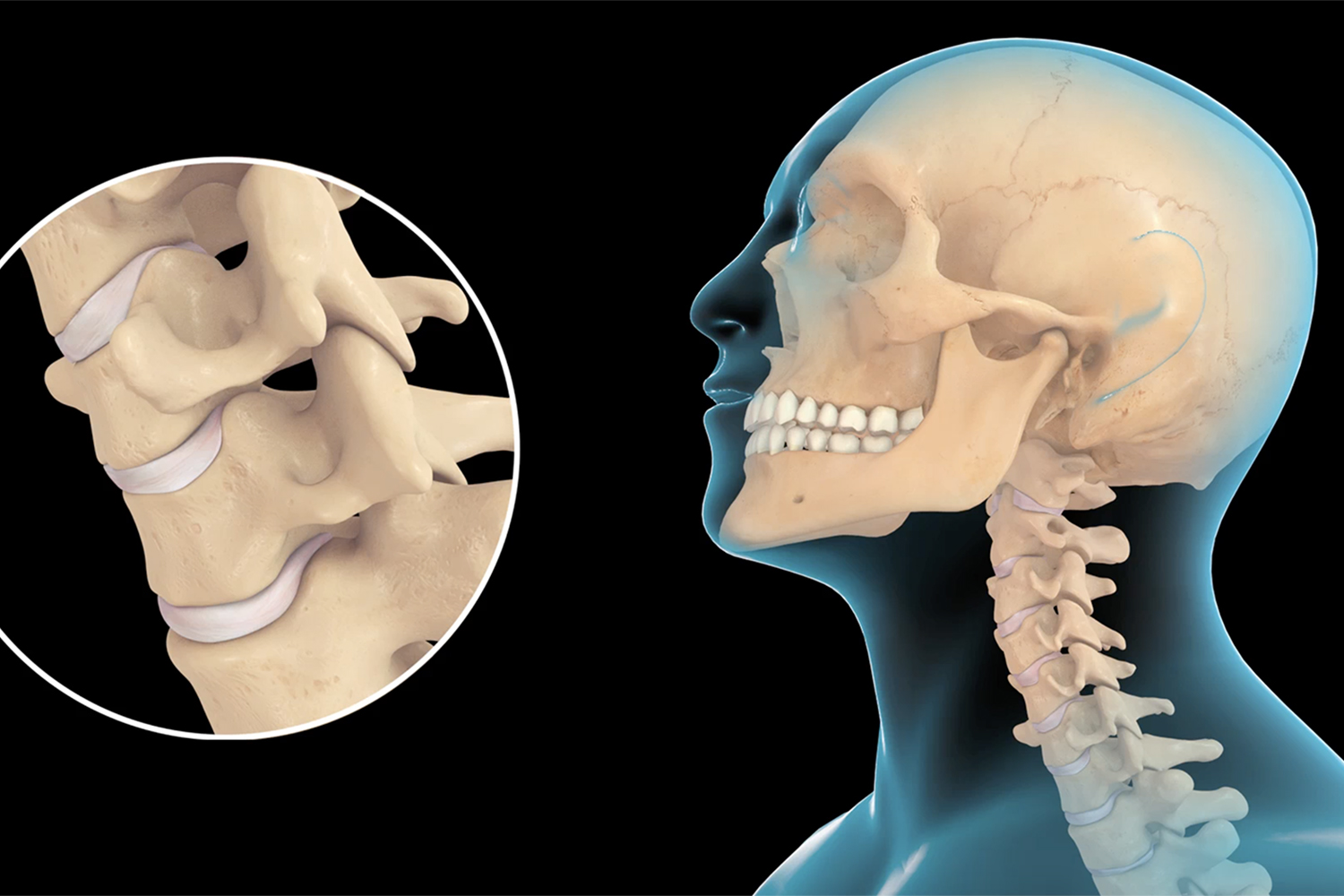 Disc Herniation or Ruptured Disc Treated by Spine Doctors – Baltimore, MD