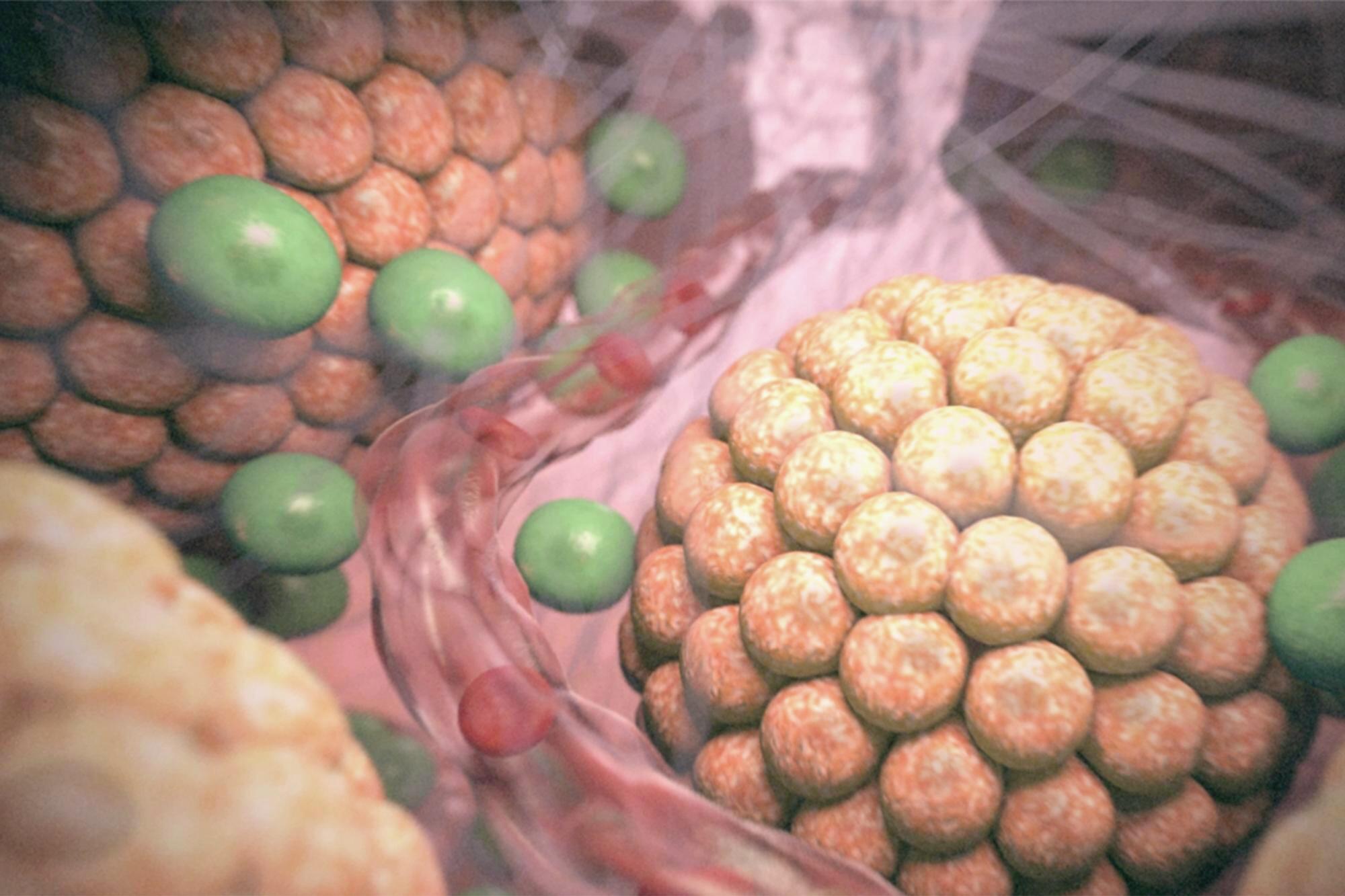 Fine-needle Aspiration Biopsy by Thyroid Doctors - Baltimore- Mercy