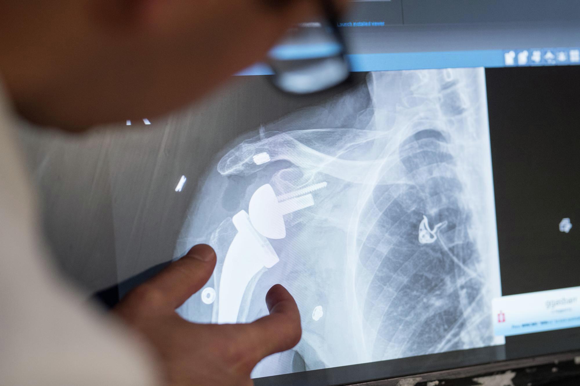 On-site X-ray Services at Mercy - Baltimore, Lutherville, Glen Burnie ...