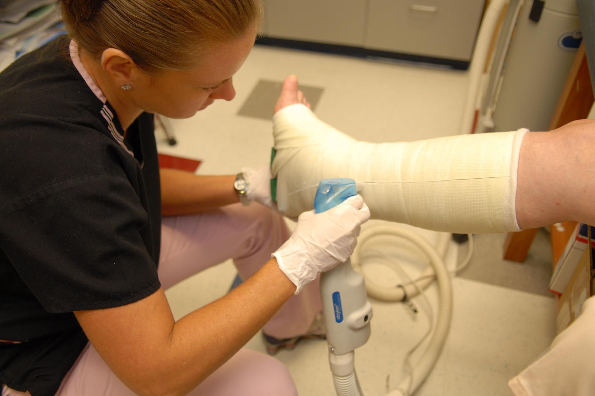 Cast Services & Total Contact Casting Offered by Top Foot Doctors in ...