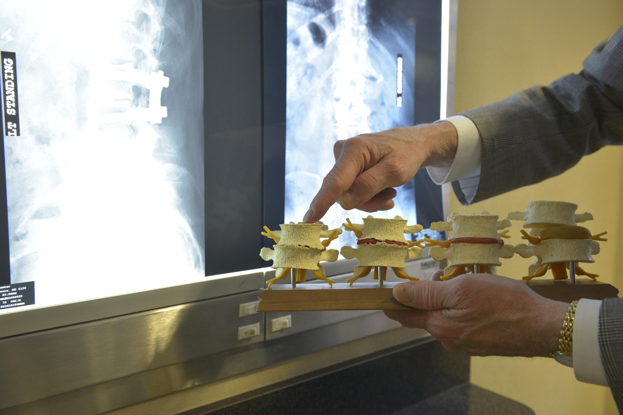 Discectomy and Microdiscectomy by Spine Surgeons - Baltimore, MD