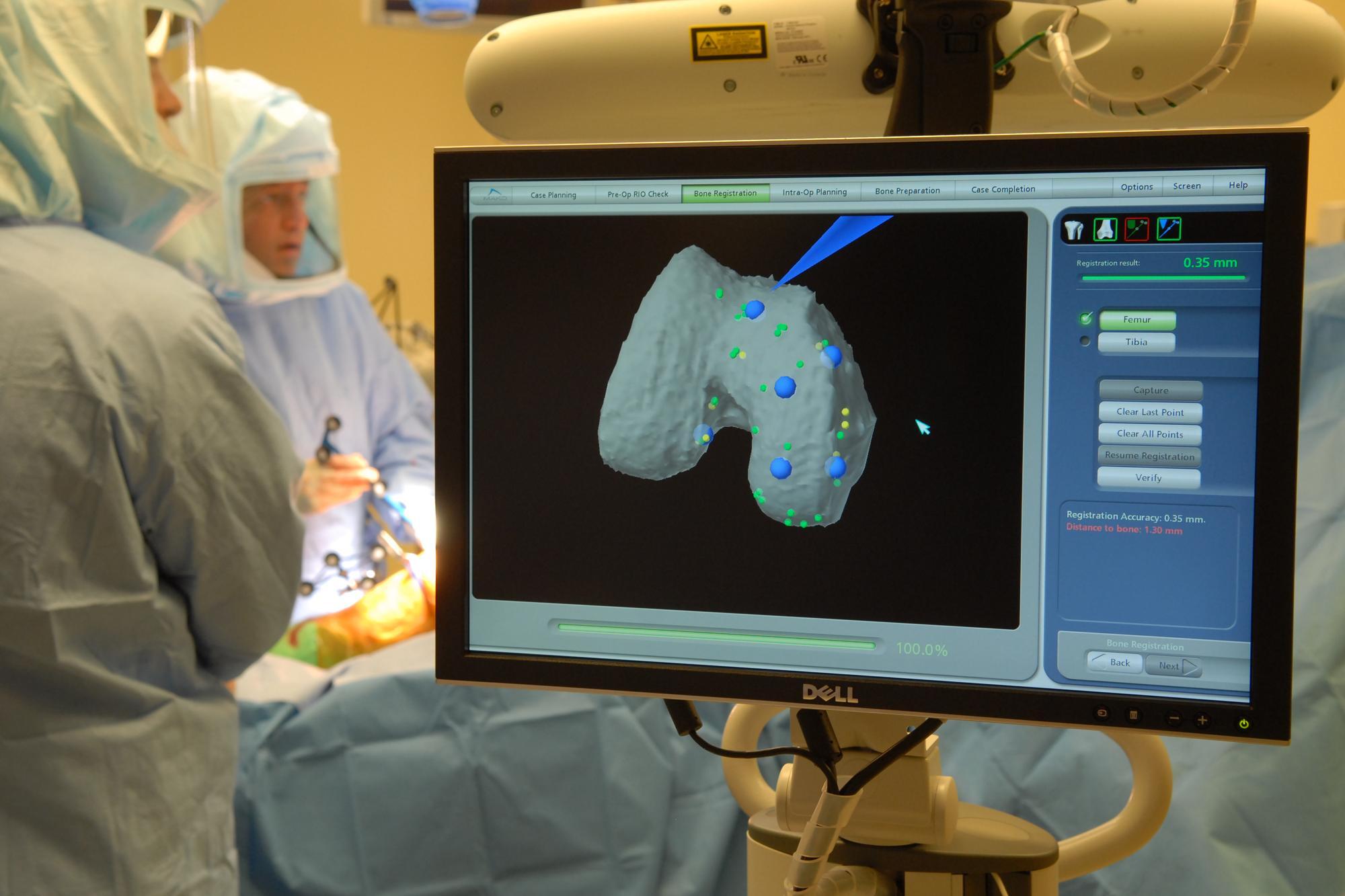 Mako Total Knee Replacement Surgery Doctors - Mercy - Baltimore, MD